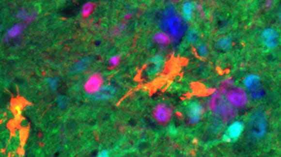 Lab-Grown Neurons Improve Breathing in Rats After Spinal Cord Injury